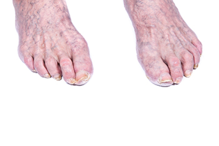 How Feet Change with Age